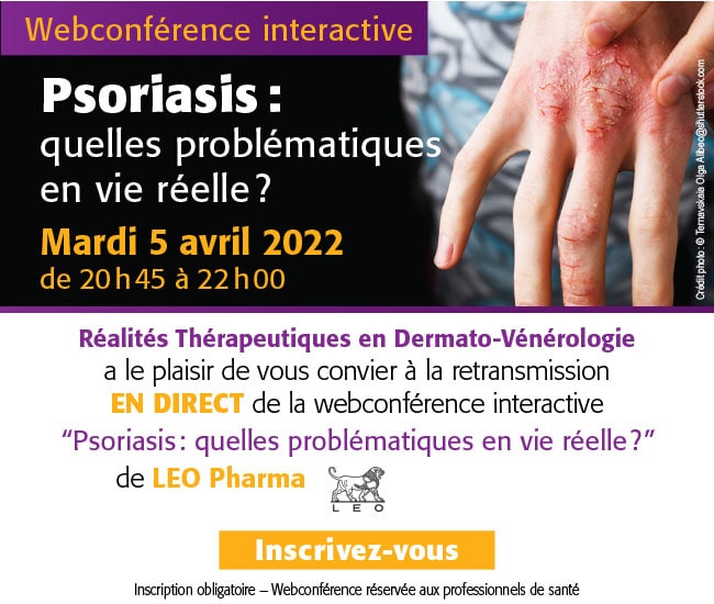 La main des dermatomyosites - Réalités thérapeutiques en Dermato ...