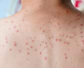 Réalités thérapeutiques en Dermato-Vénérologie - Revue médicale